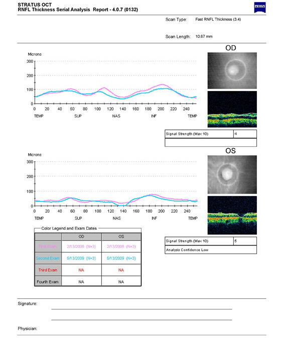 Zeiss Stratus OCT - Fab Eye Care