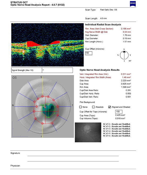 Zeiss Stratus OCT - Fab Eye Care