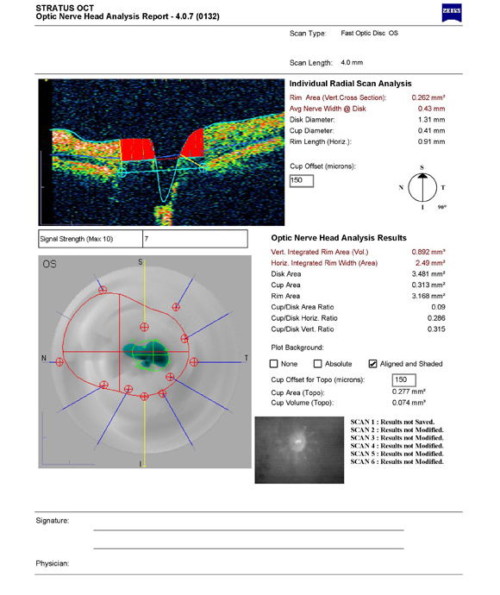 Zeiss Stratus OCT - Fab Eye Care