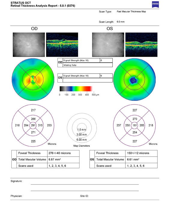 Zeiss Stratus OCT - FabEyeCare
