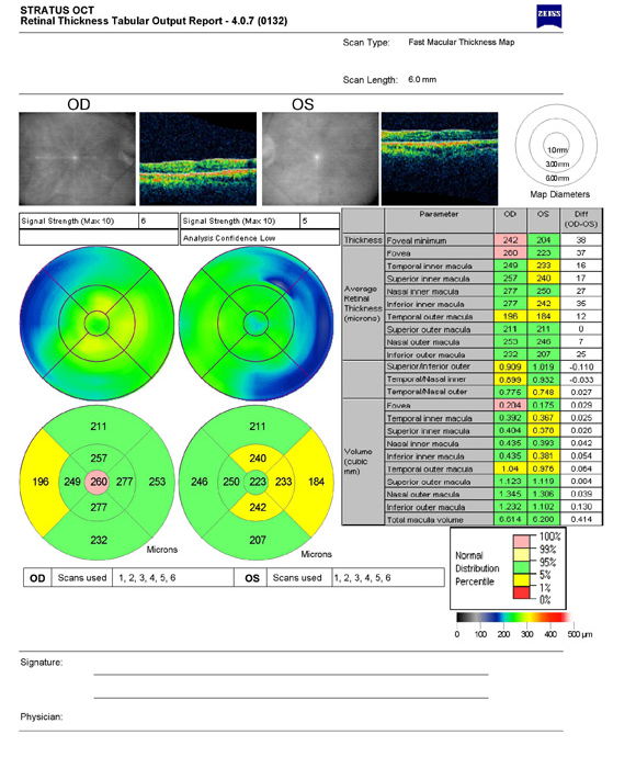 Zeiss Stratus OCT - FabEyeCare