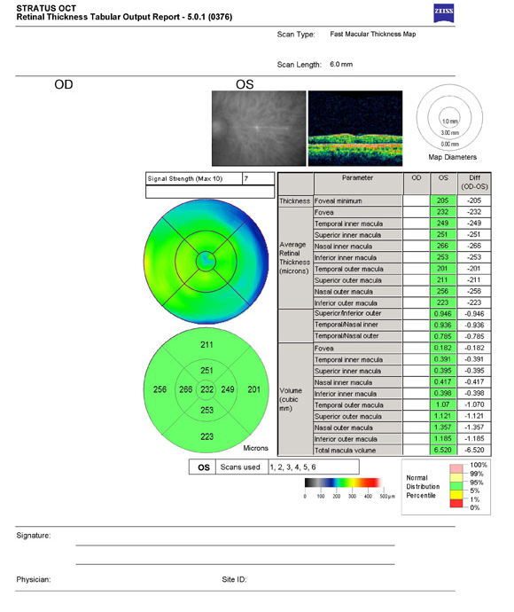 Zeiss Stratus OCT - Fab Eye Care