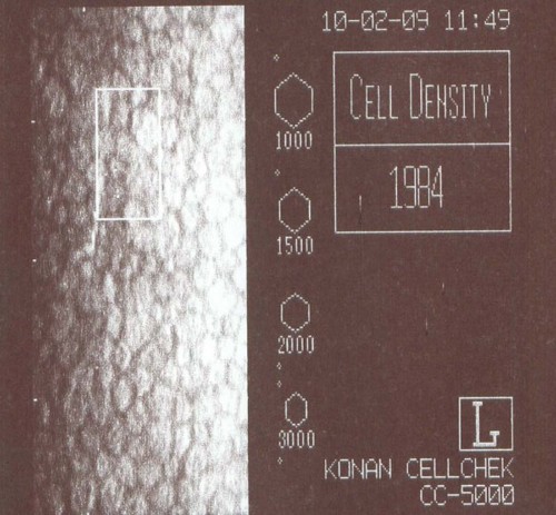 Endothelial Cell Counter - Fab Eye Care