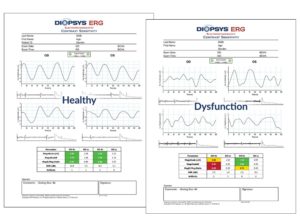 Office-based pattern electroretinography (pERG) module - Fab Eye Care