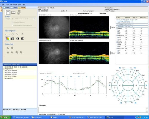 Optovue – RTVue SD-OCT