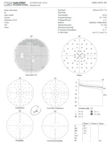Humphrey Visual Field - Fab Eye Care
