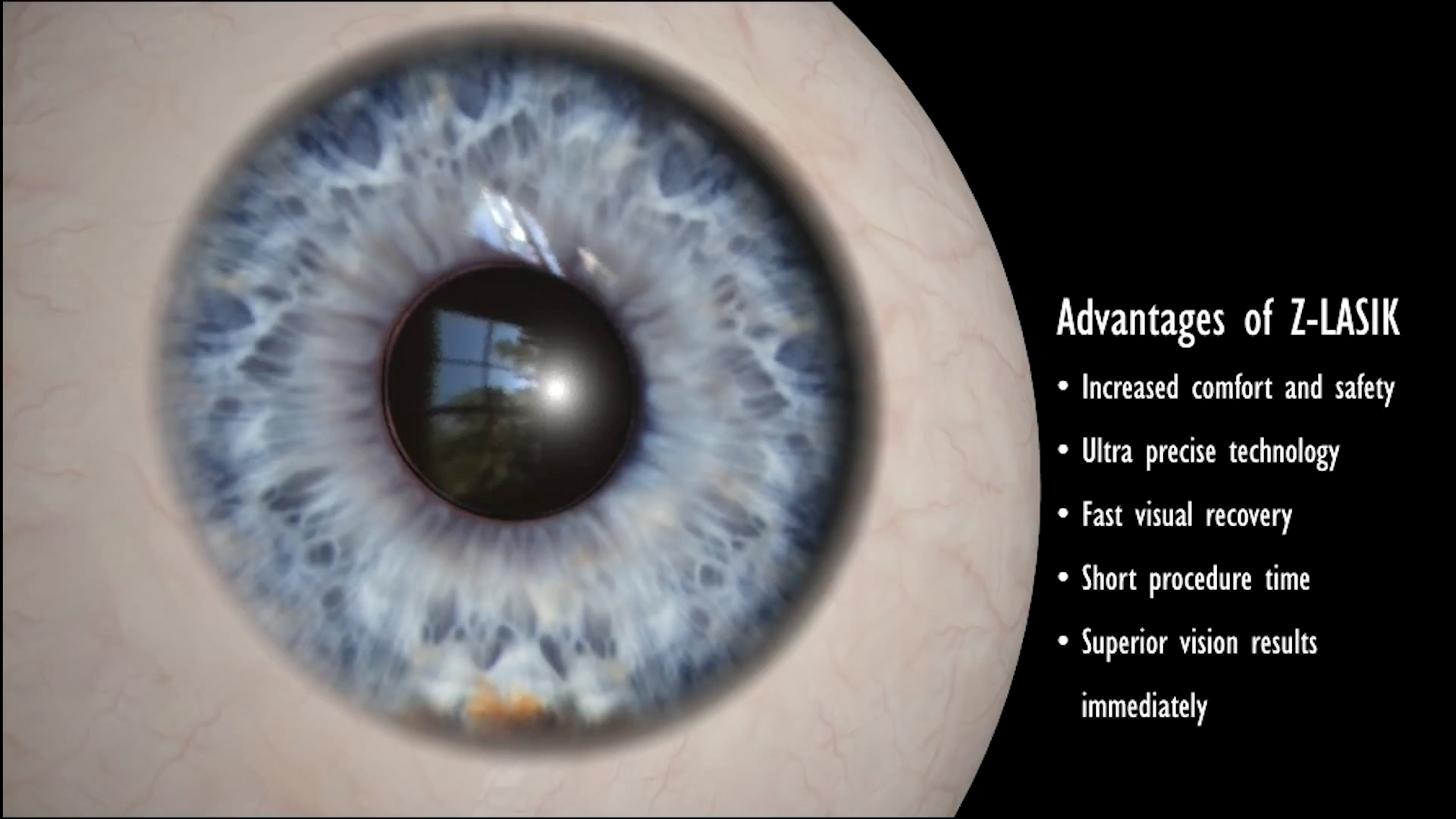 Ziemer Z4 femtosecond laser Bladeless LASIK - Fab Eye Care