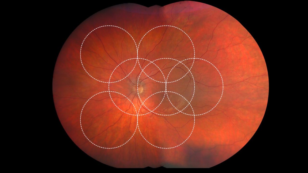 Clarus 500 - Fab Eye Care